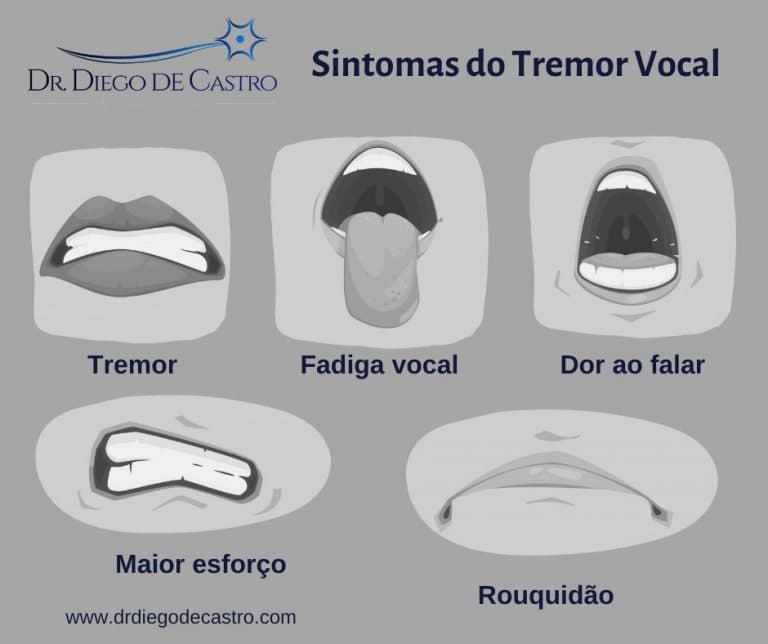Tremor Vocal ou Laríngeo - Saiba Mais sobre o Tremor na Voz